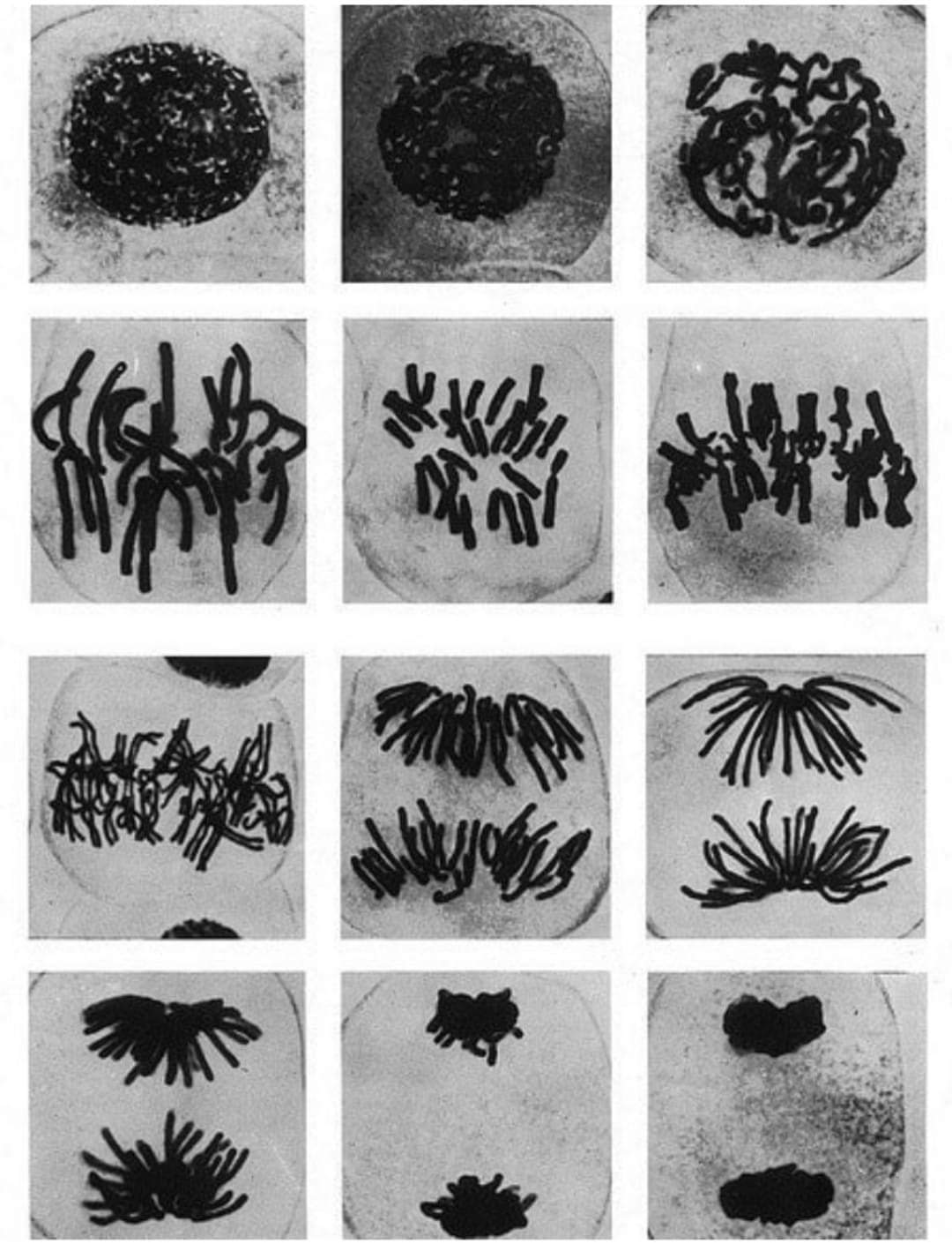 Etapas De La Mitosis Bajo El Microscopio División Celular, Mitosis Y