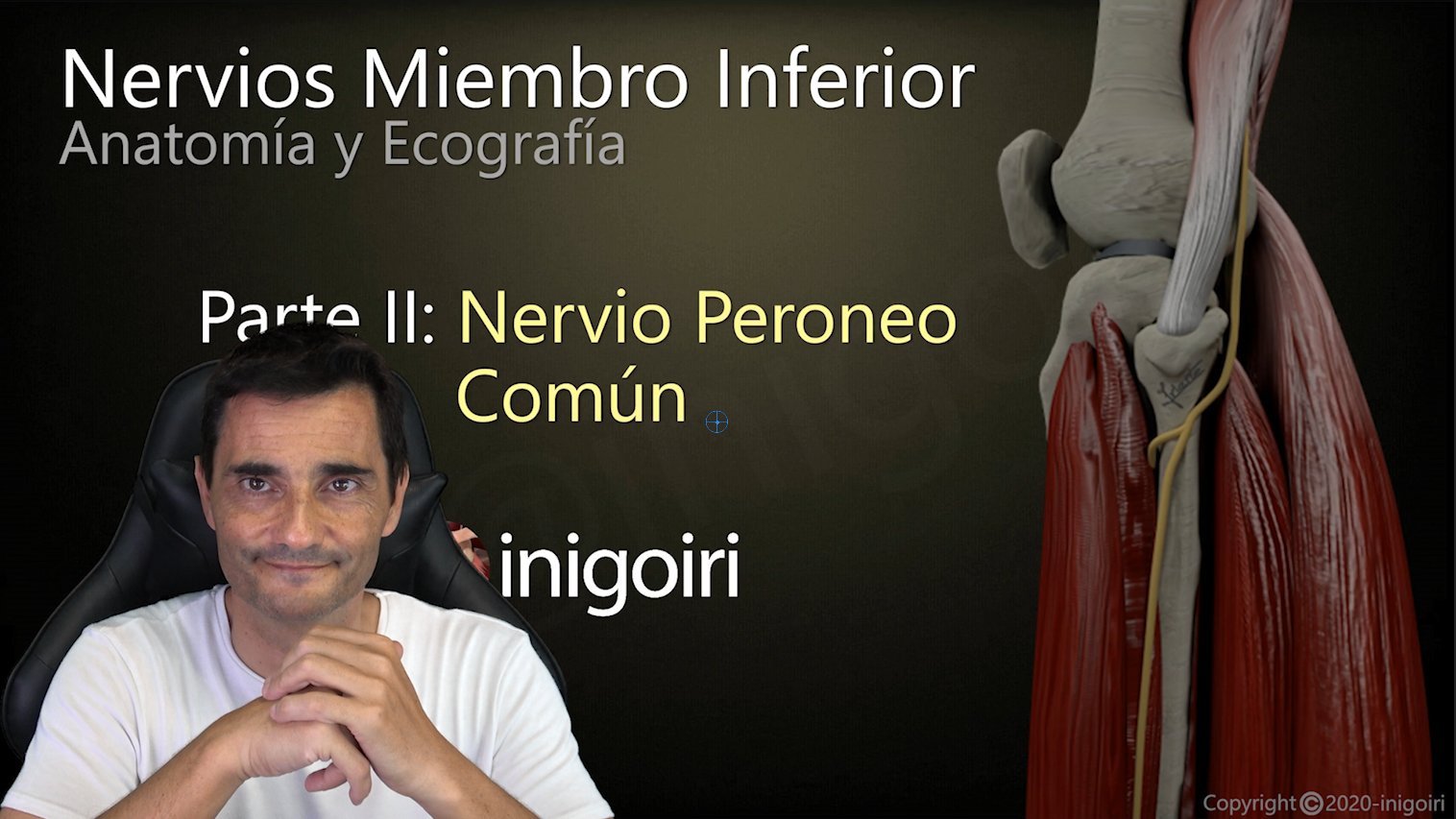 Anatomía Del Nervio Peroneo Común Nervio Fibular Común E Anatomy