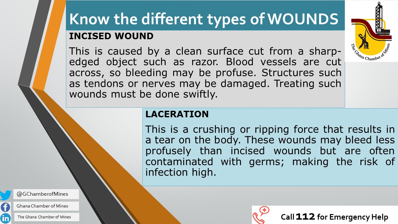 Incised Wound Vs Laceration