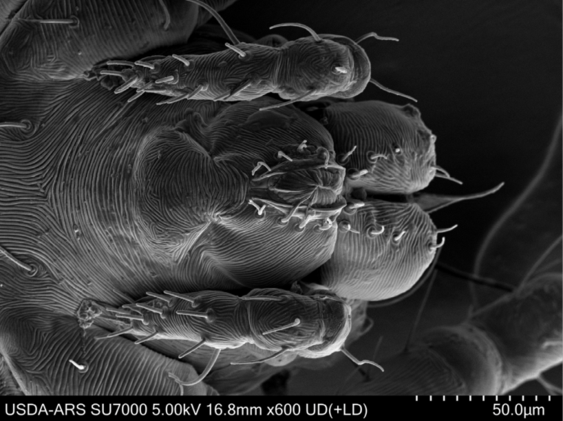Dust Mite Electron Microscope