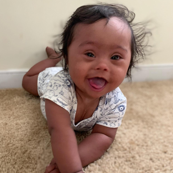 Black Down Syndrome Baby