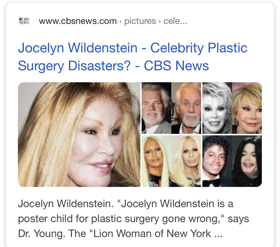 Does Jocelyn Wildenstein Have Children