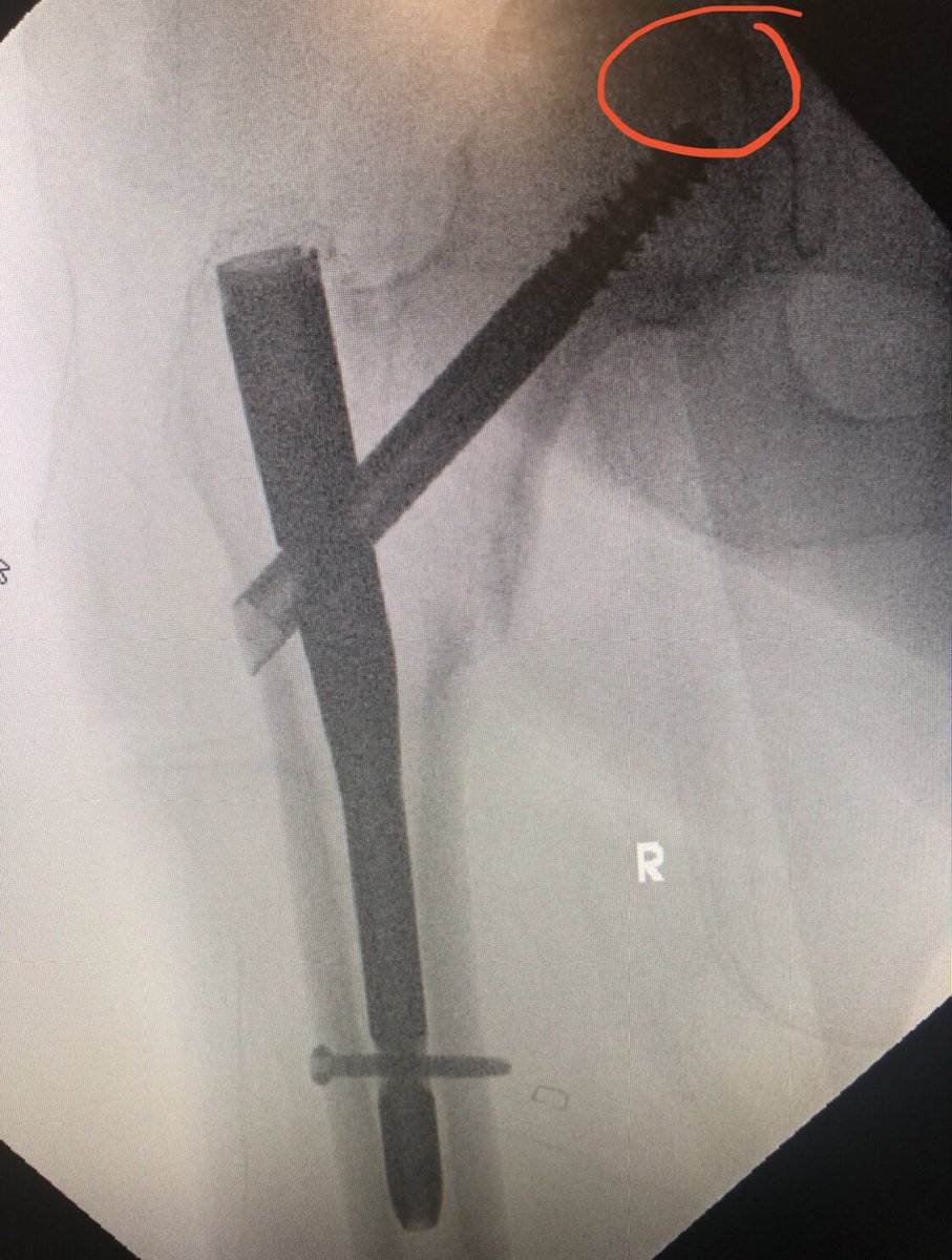 [1/11] JBJS March 2009: classic instructional course lecture titled ...