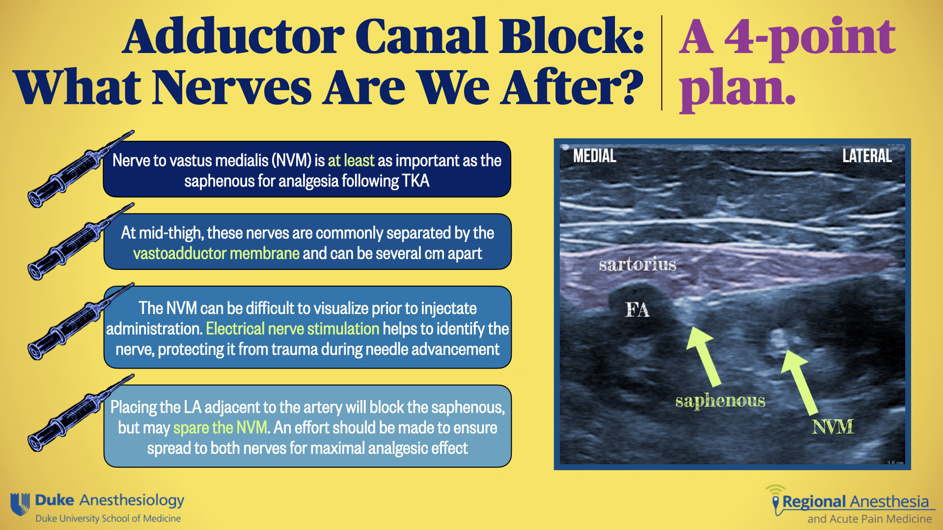 Adductor Canal Block