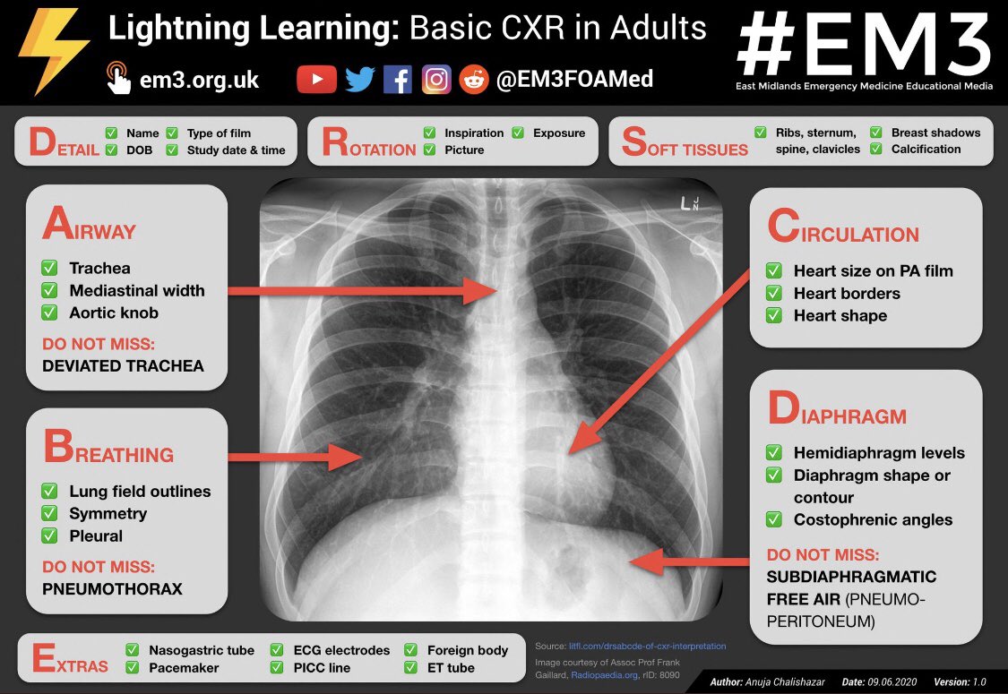 Intensive Care Nursing/Chest X-Ray Interpretation, 40% OFF
