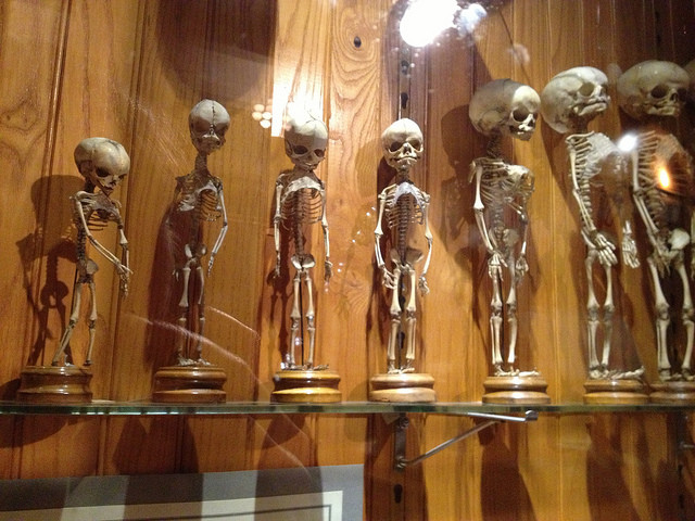 Mutter Museum Fetus