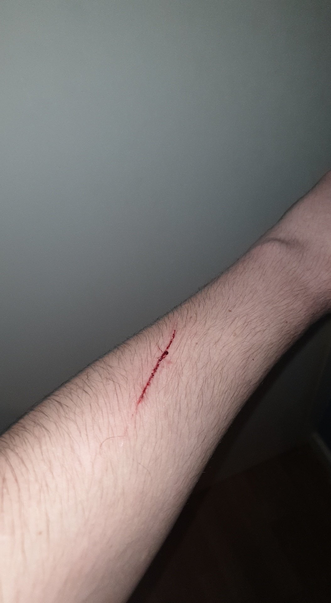 Cut On Arm