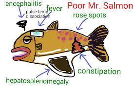 Salmonella Typhi Rose Spots