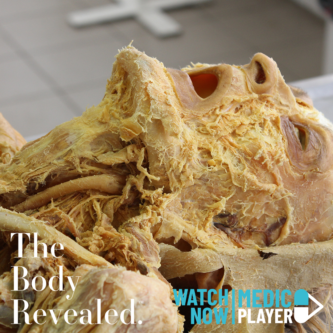 Whole Body Dissection Human Body Wikipedia