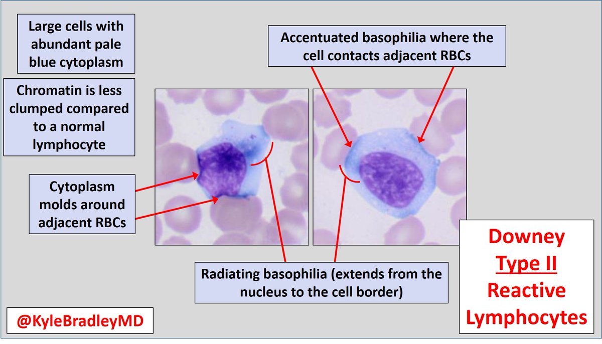 Reactive Lymphocytes Vs Monocytes