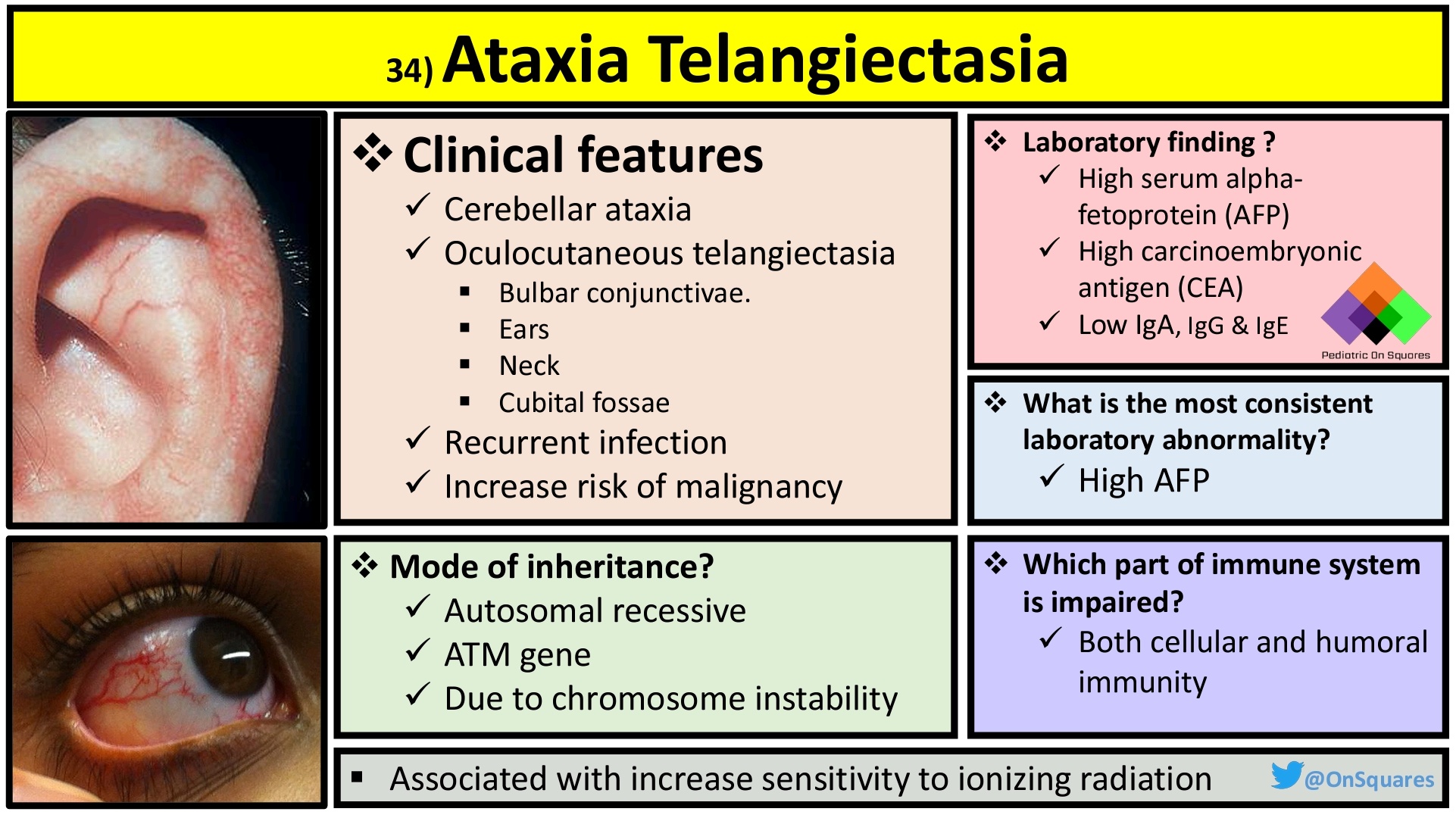 Ataxia Telangiectasia Gene
