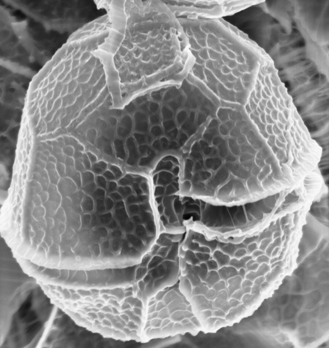 Peridinium Under Microscope