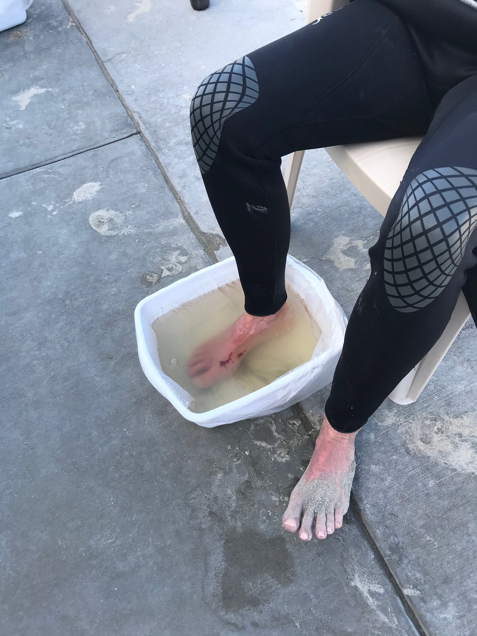 Stingray Sting Foot