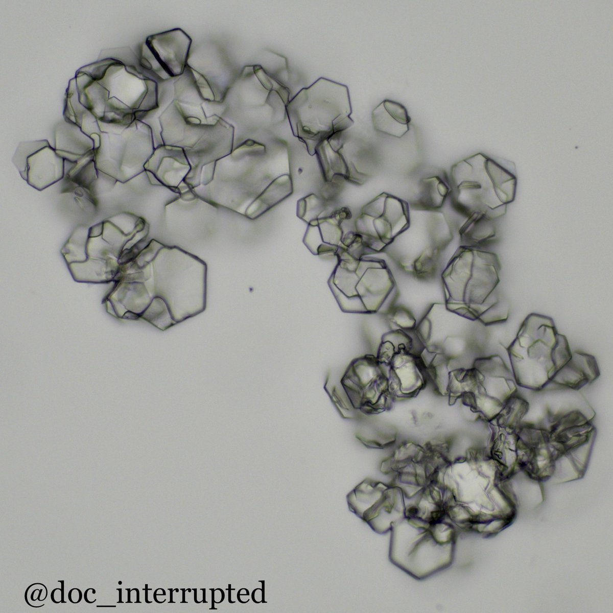 Cystine Crystals In Urine