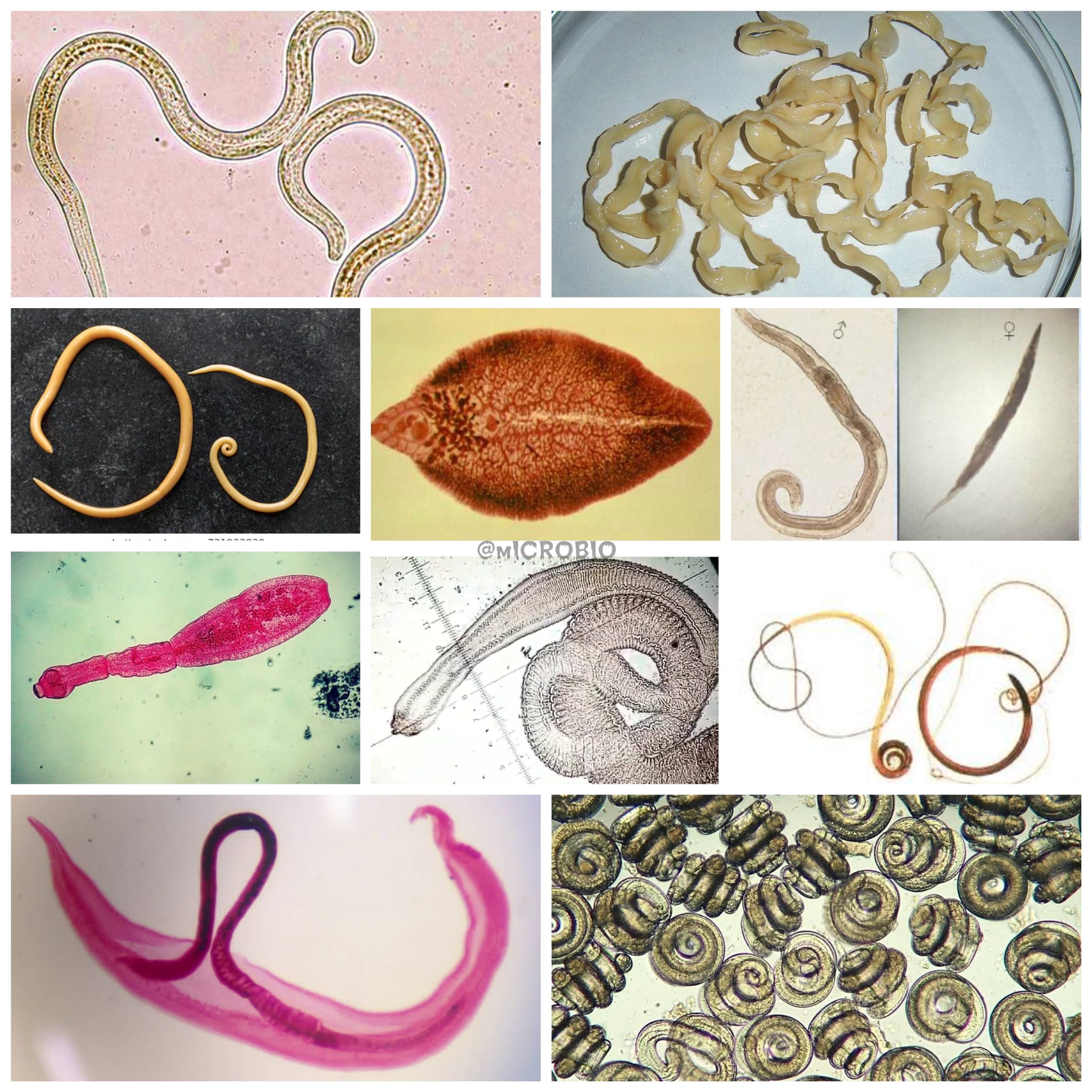 Phylum Aschelminthes Ascaris