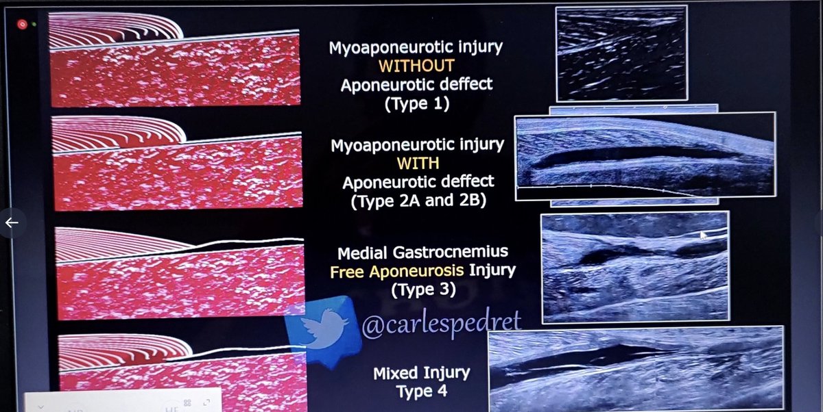 Thread by @lorenzo_masci on Thread Reader App – Thread Reader App