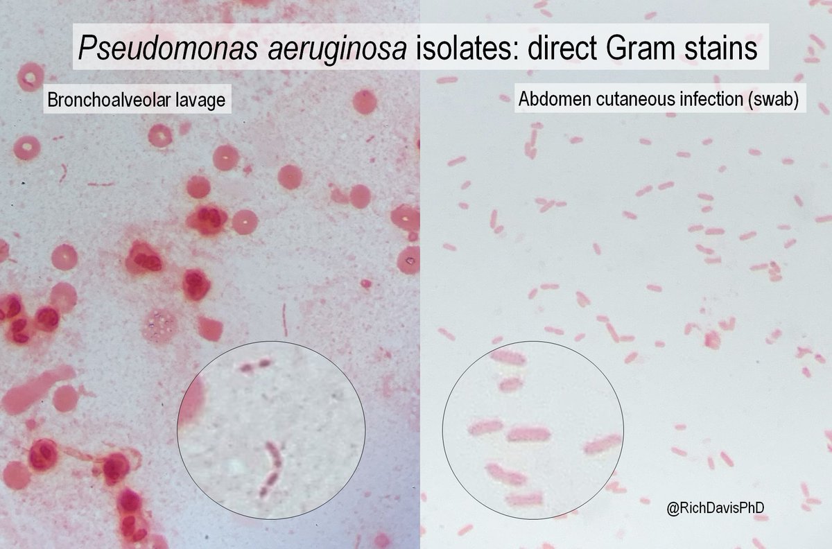 Pseudomonas Aeruginosa Gram Stain