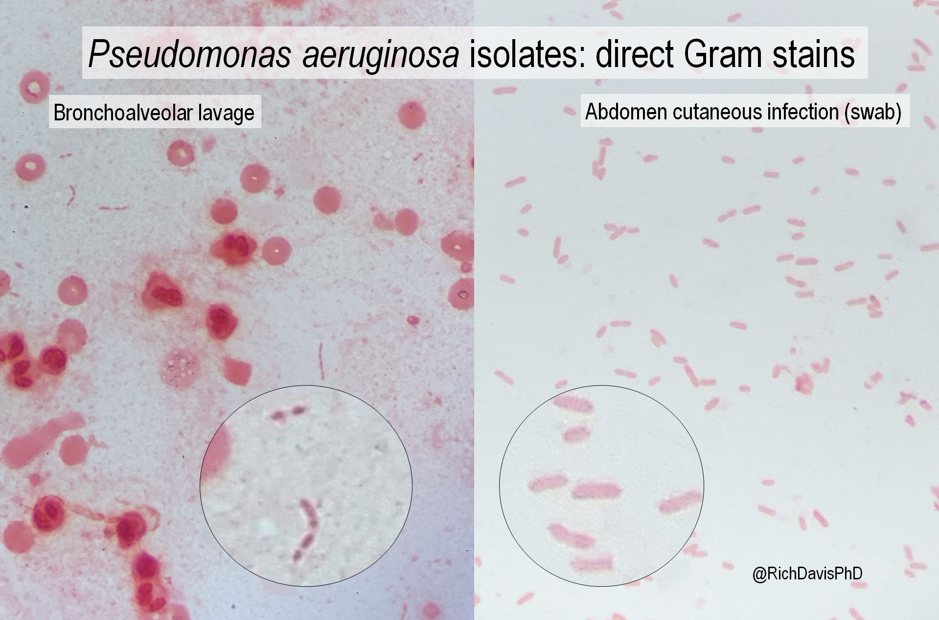 Pseudomonas Aeruginosa Gram Stain