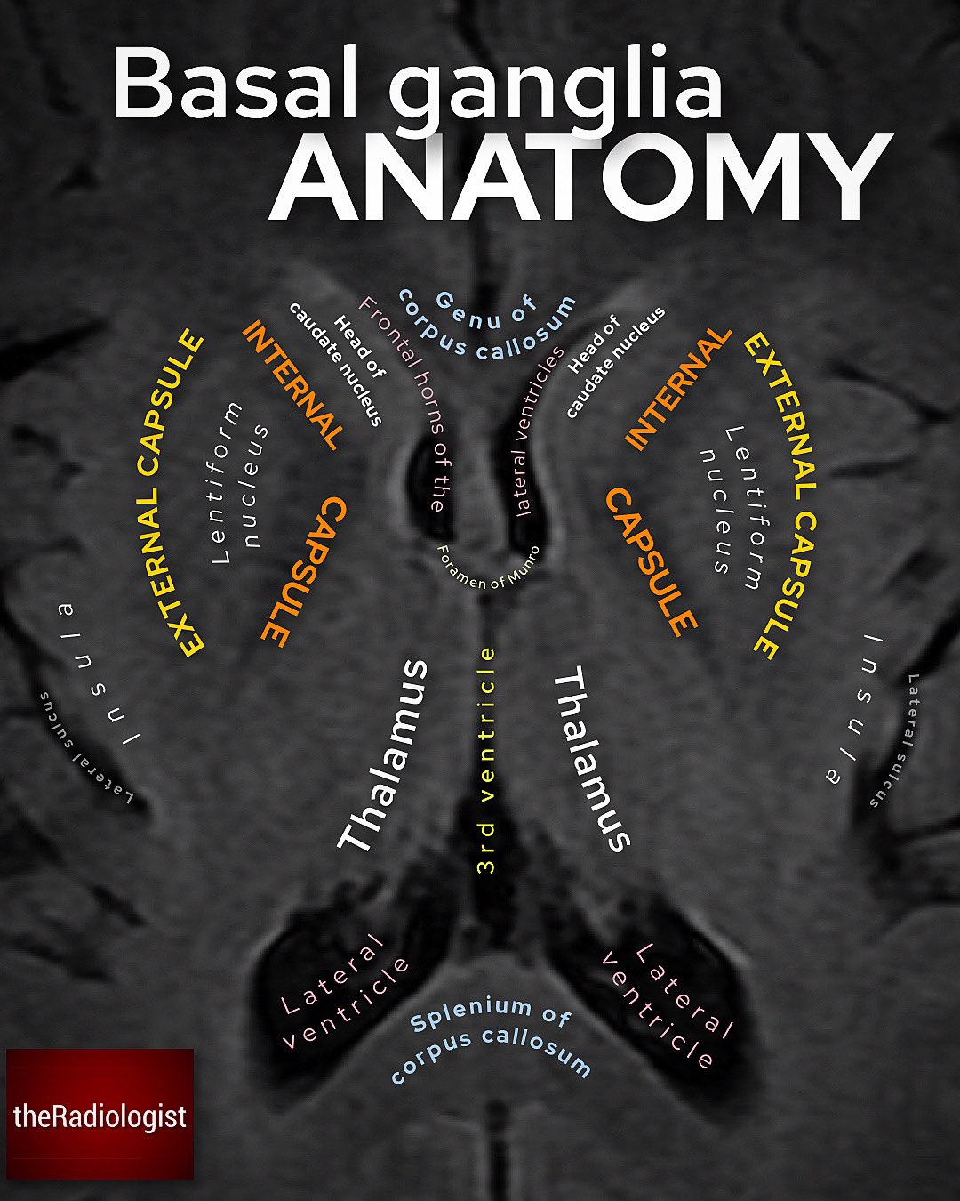 Sagittal Mri Brain Anatomy Clinical Features Clinical Features
