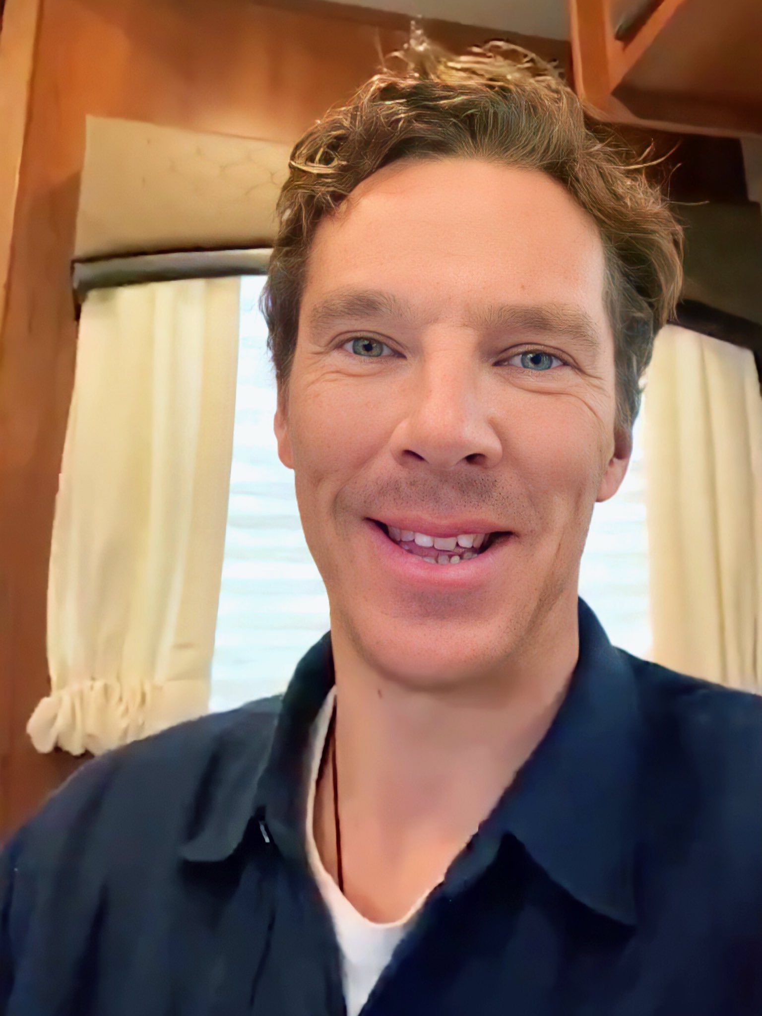 Benedict Cumberbatch Teeth