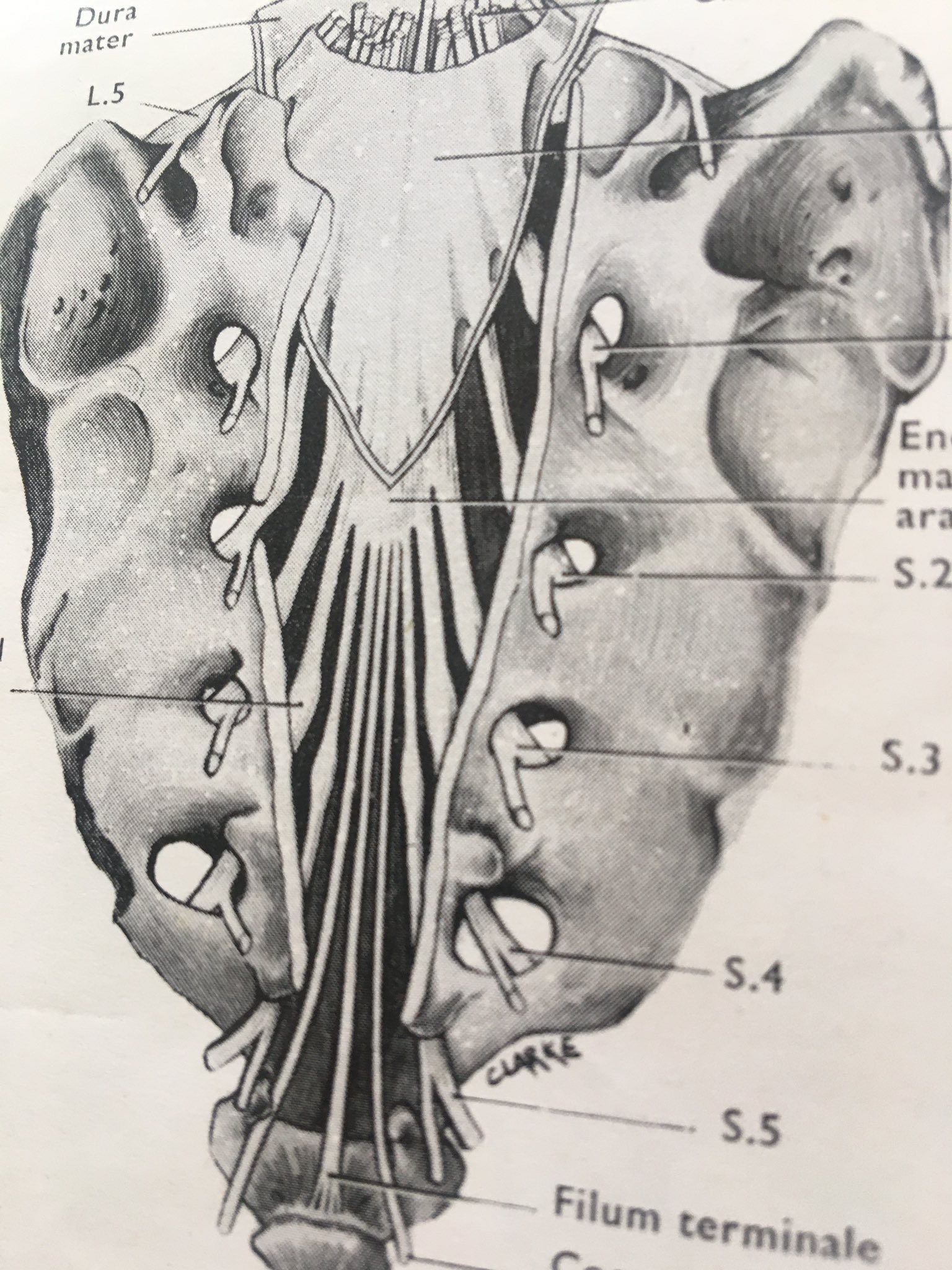 Inferior Lateral Angle Of Sacrum