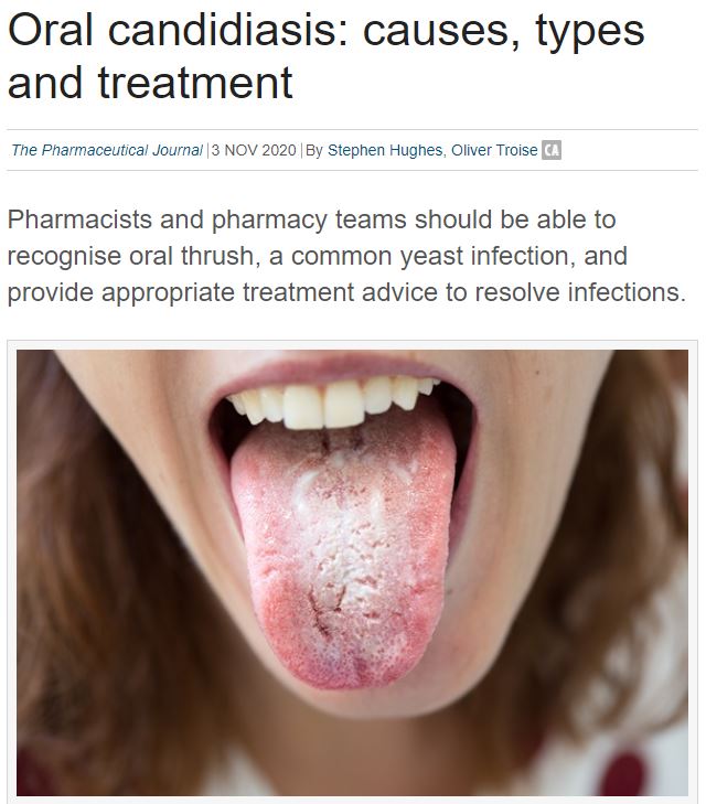 Oral Candidiasis Causes Types And Treatment Pdf Pdf 57 Off