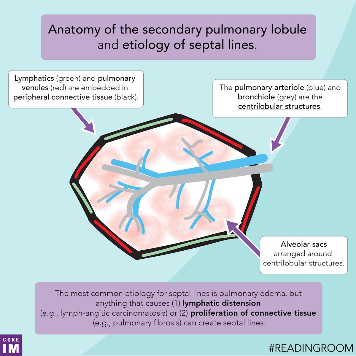 Secondary Pulmonary Lobule