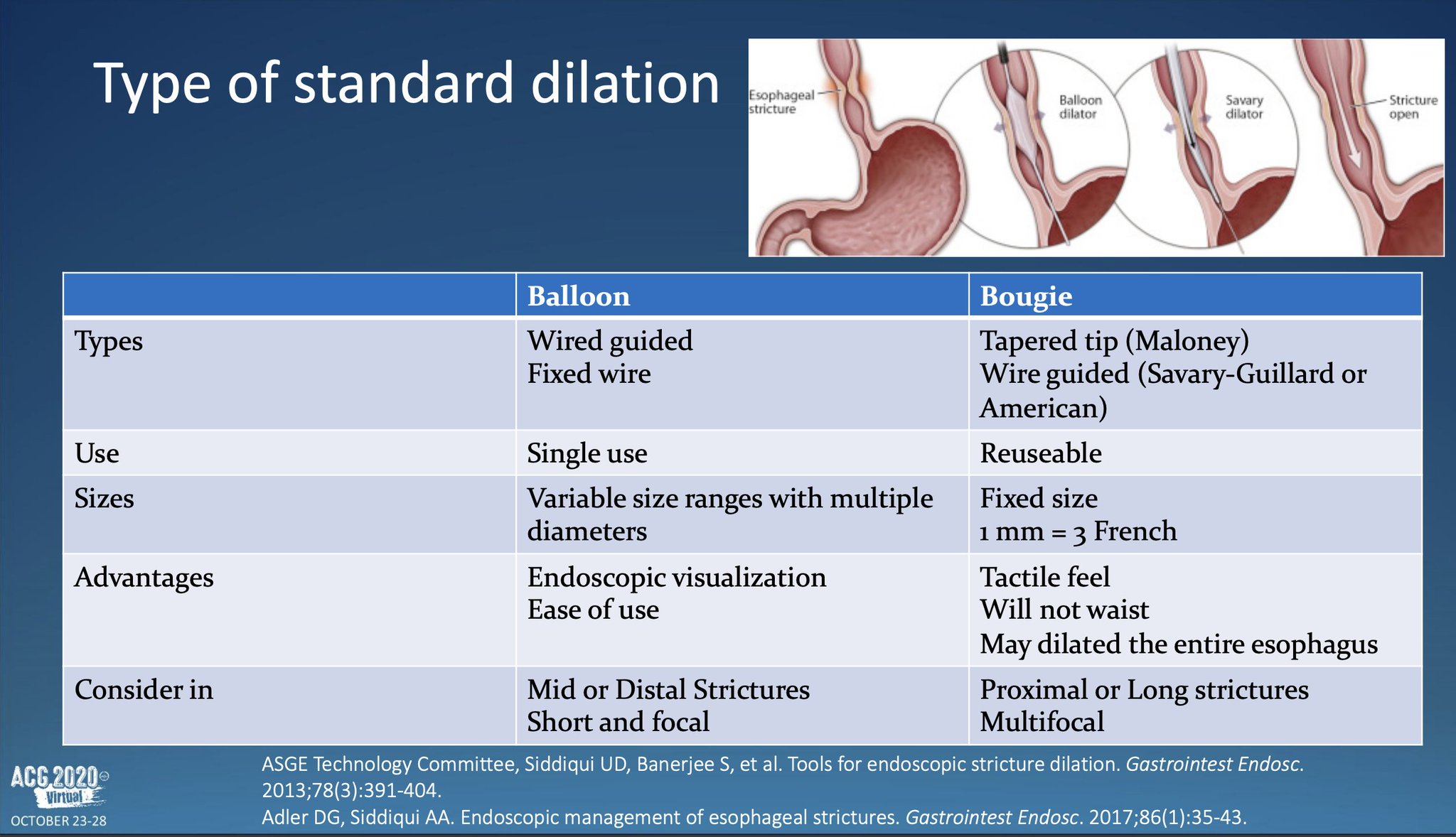 Esophageal Stricture Dilation