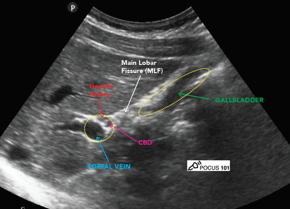 Liver Portal Triad Histology Liver Gallbladder