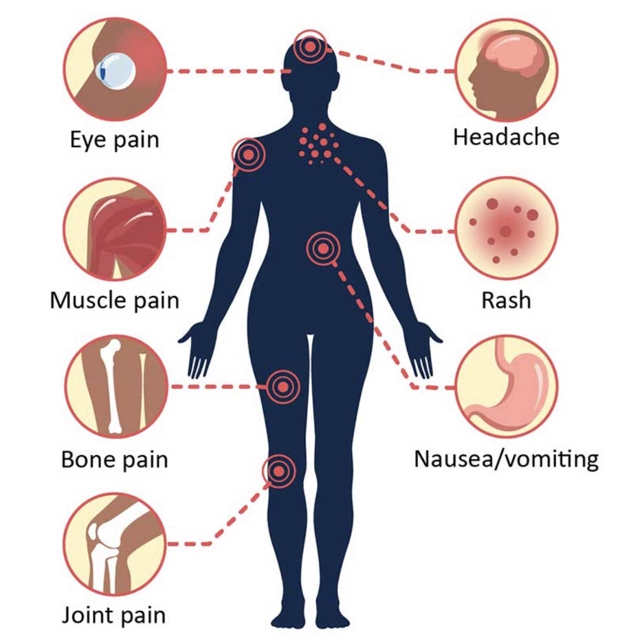 #MayoIDQ 40M. Return from Mexico: 5d fever, HA, myalgia, malaise ...