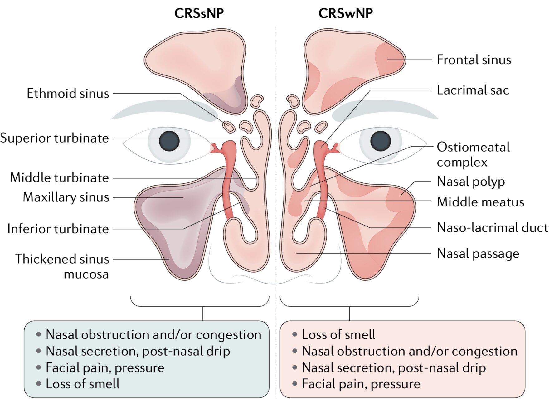 MedClub on Twitter: "#Otorrinolaringología #MedicinaInterna Anatomía de los senos paranasales y ...