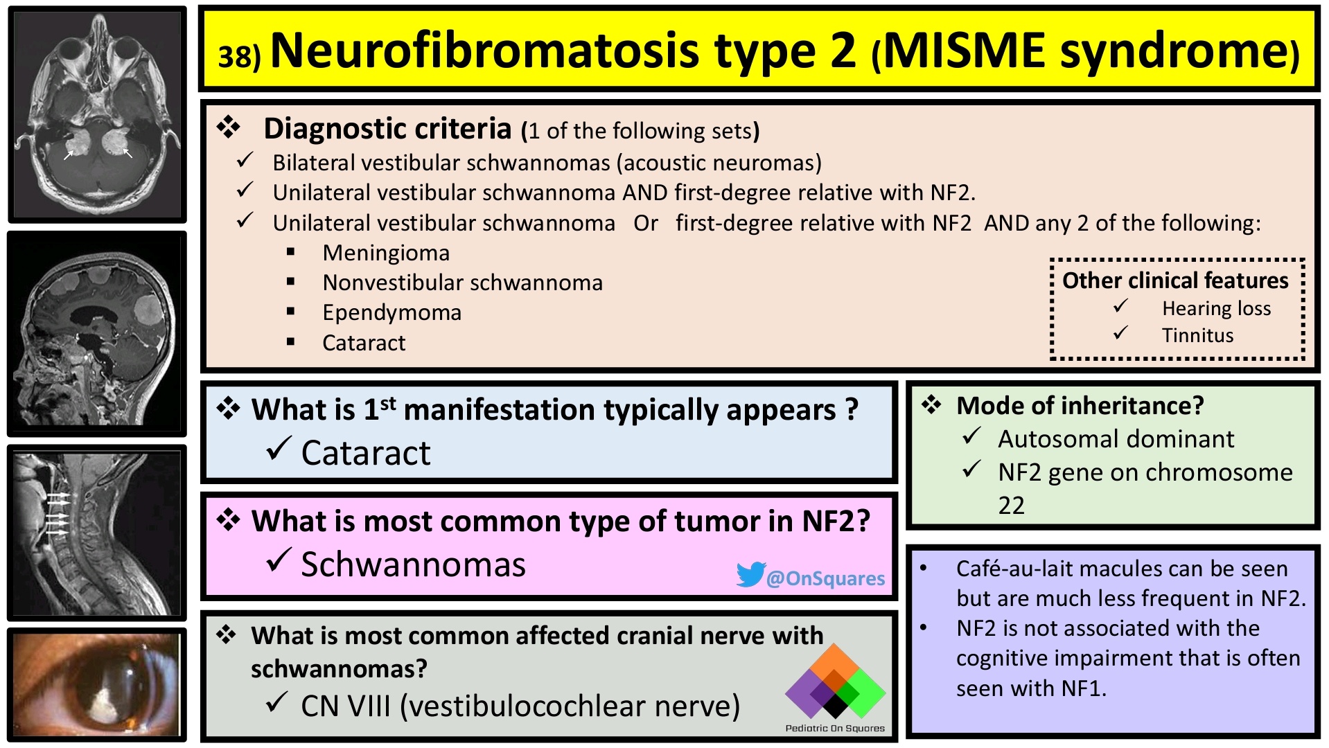 Neurofibromatosis Type Ii