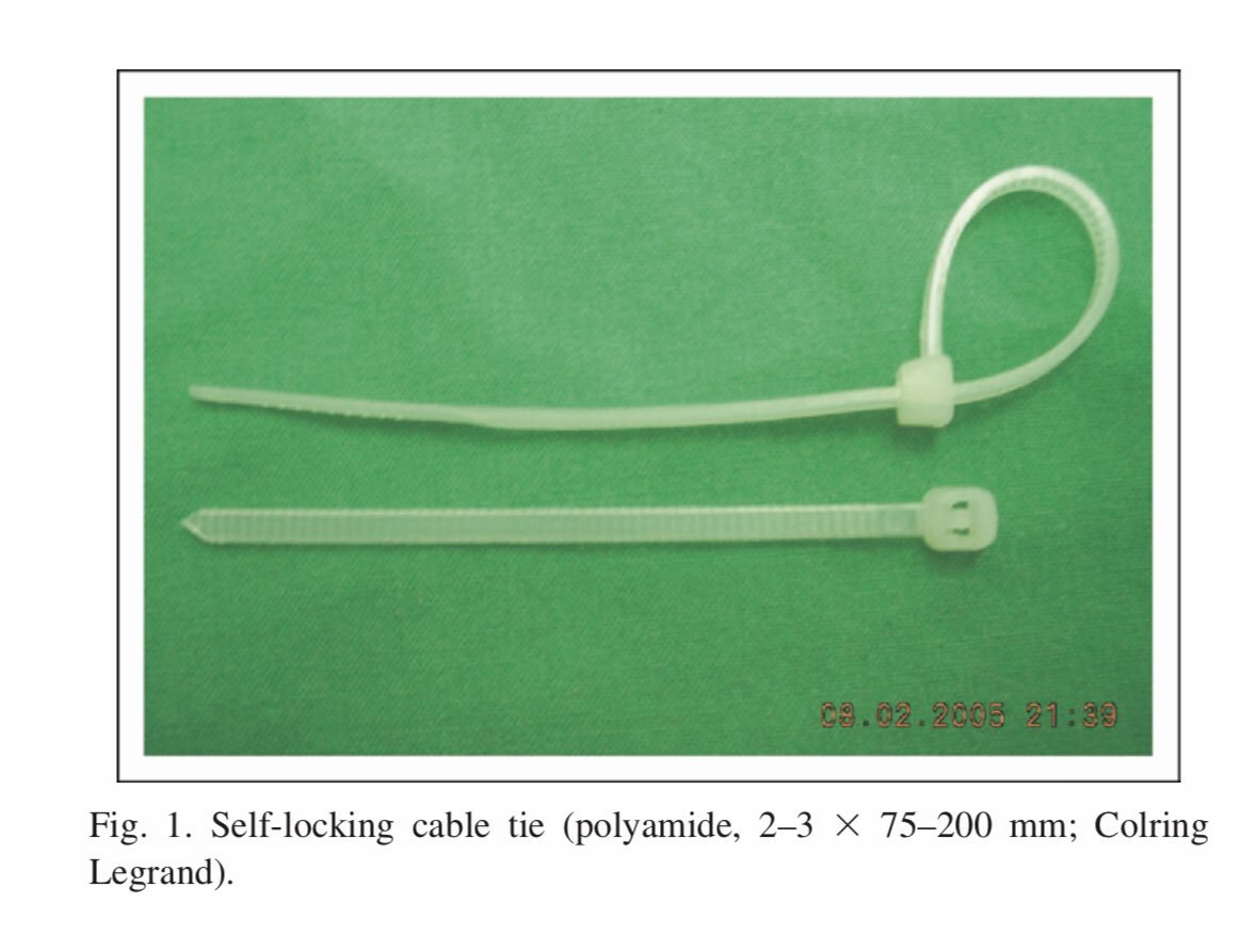 Fistula In Ano Seton Treatment