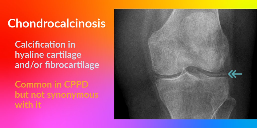 Chondrocalcinosis