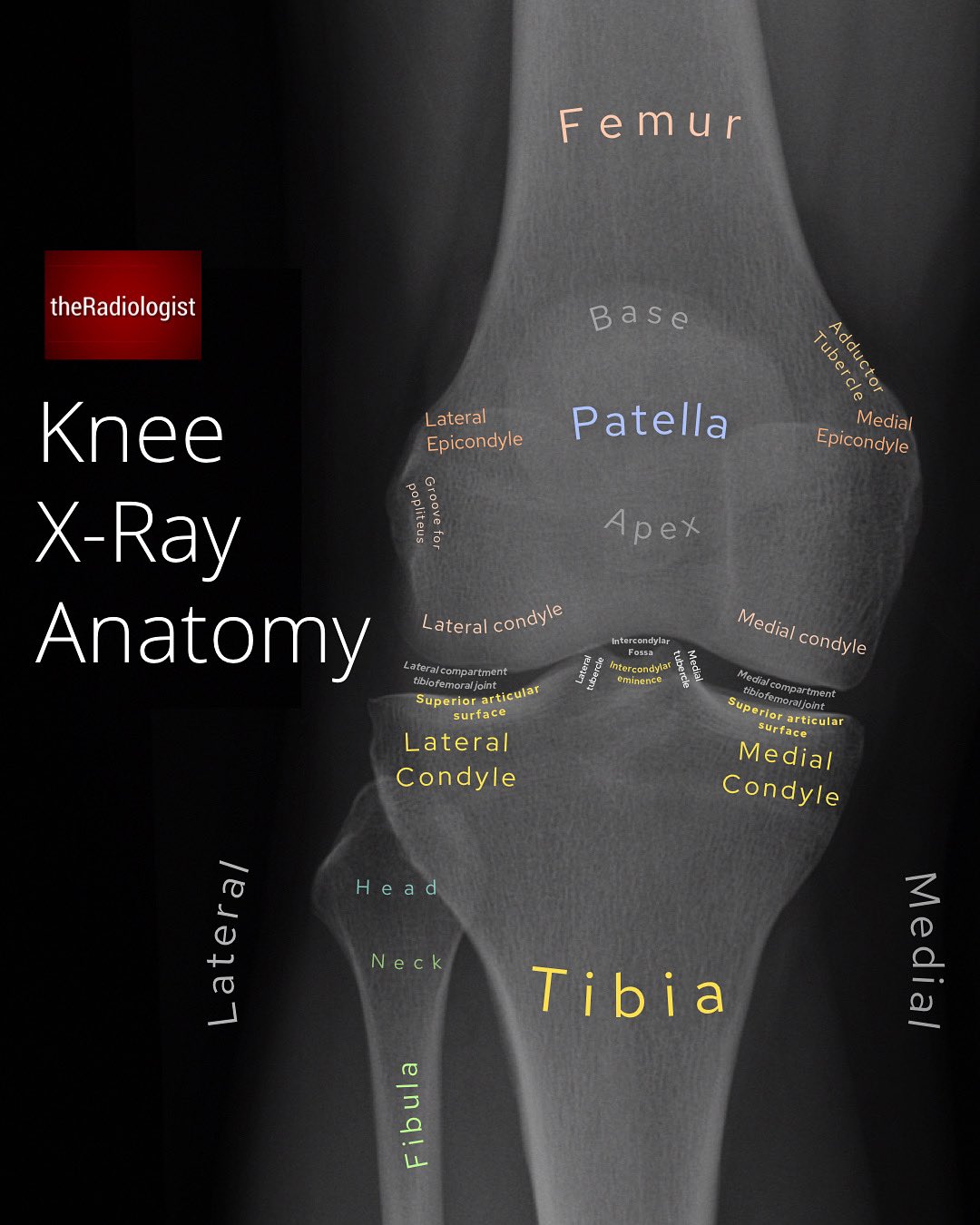 Knee Xray Anatomy Anatomy Of The Knee (CT Arthrography) | E Anatomy