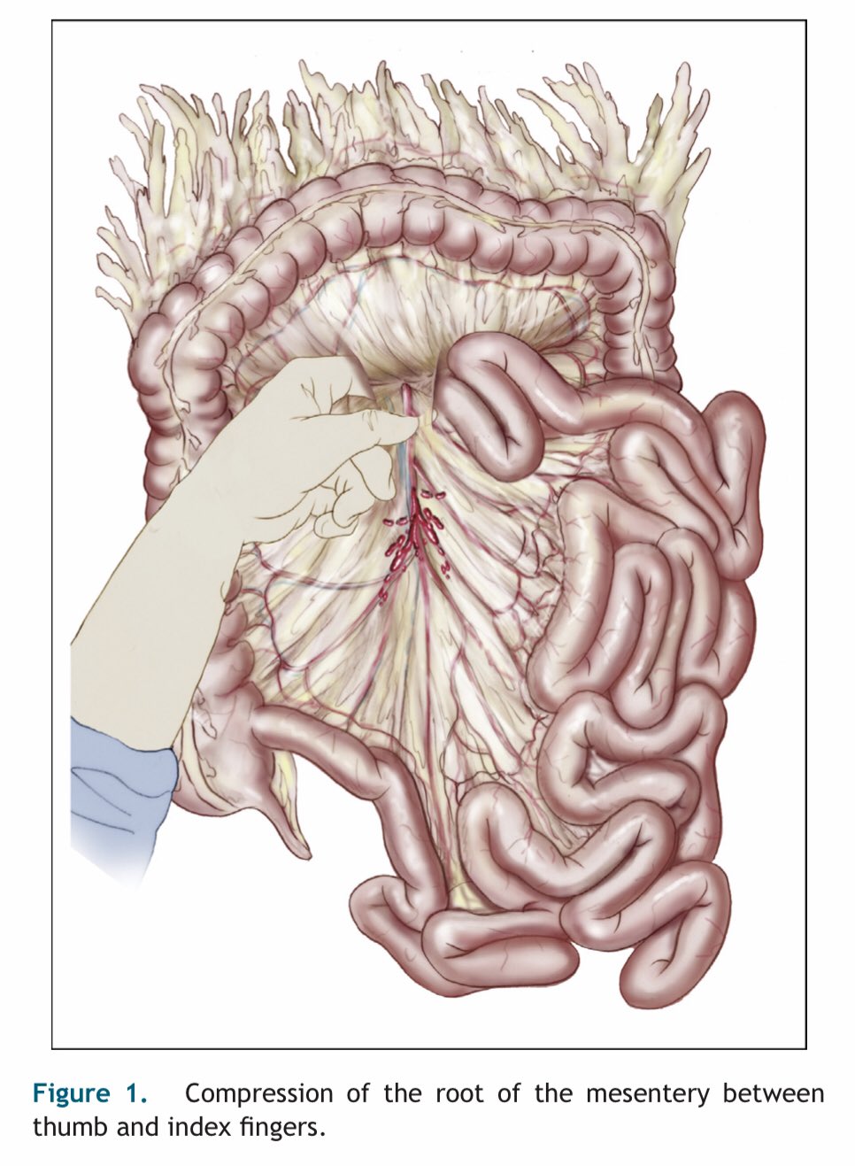 Root Of Mesentery