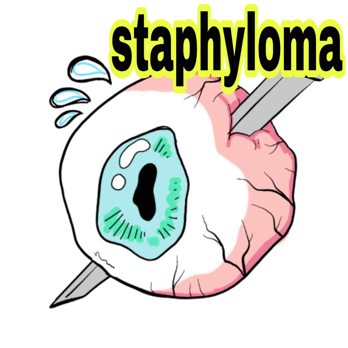 Optometry Scope (@OptometryScope) | Twitter