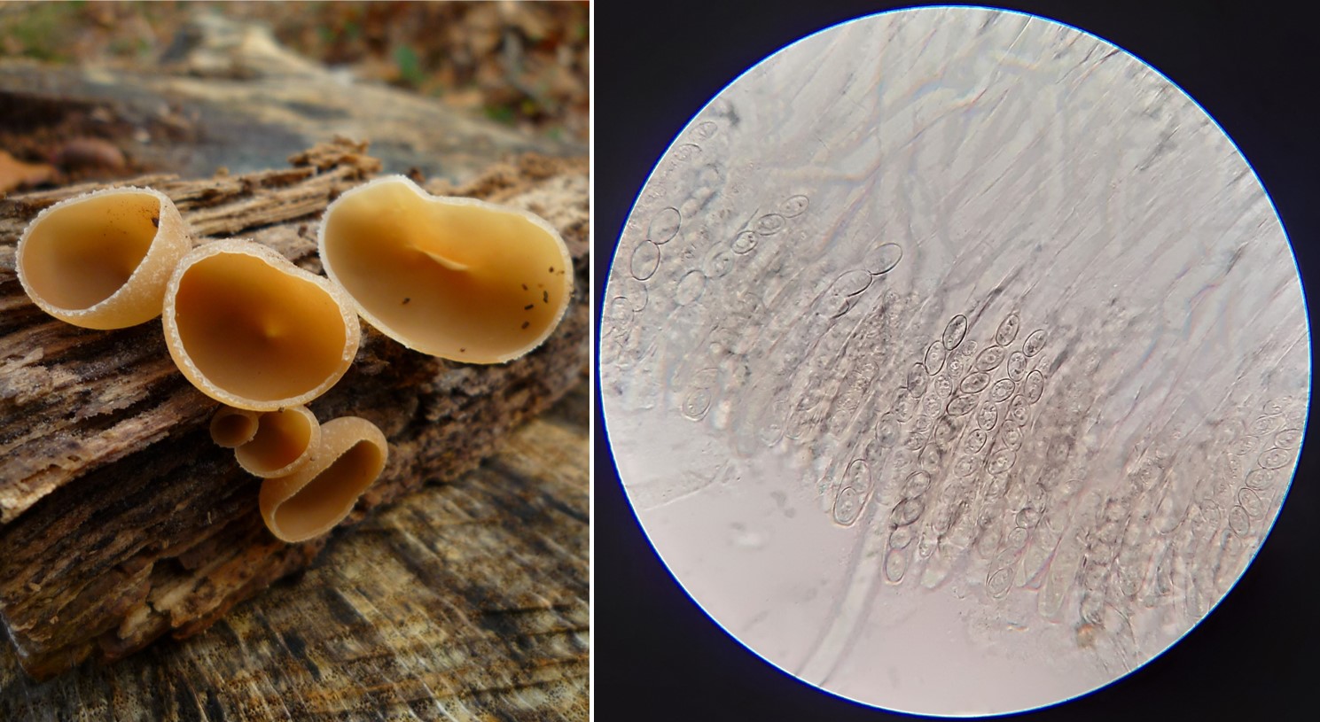 Peziza Asci And Ascospores