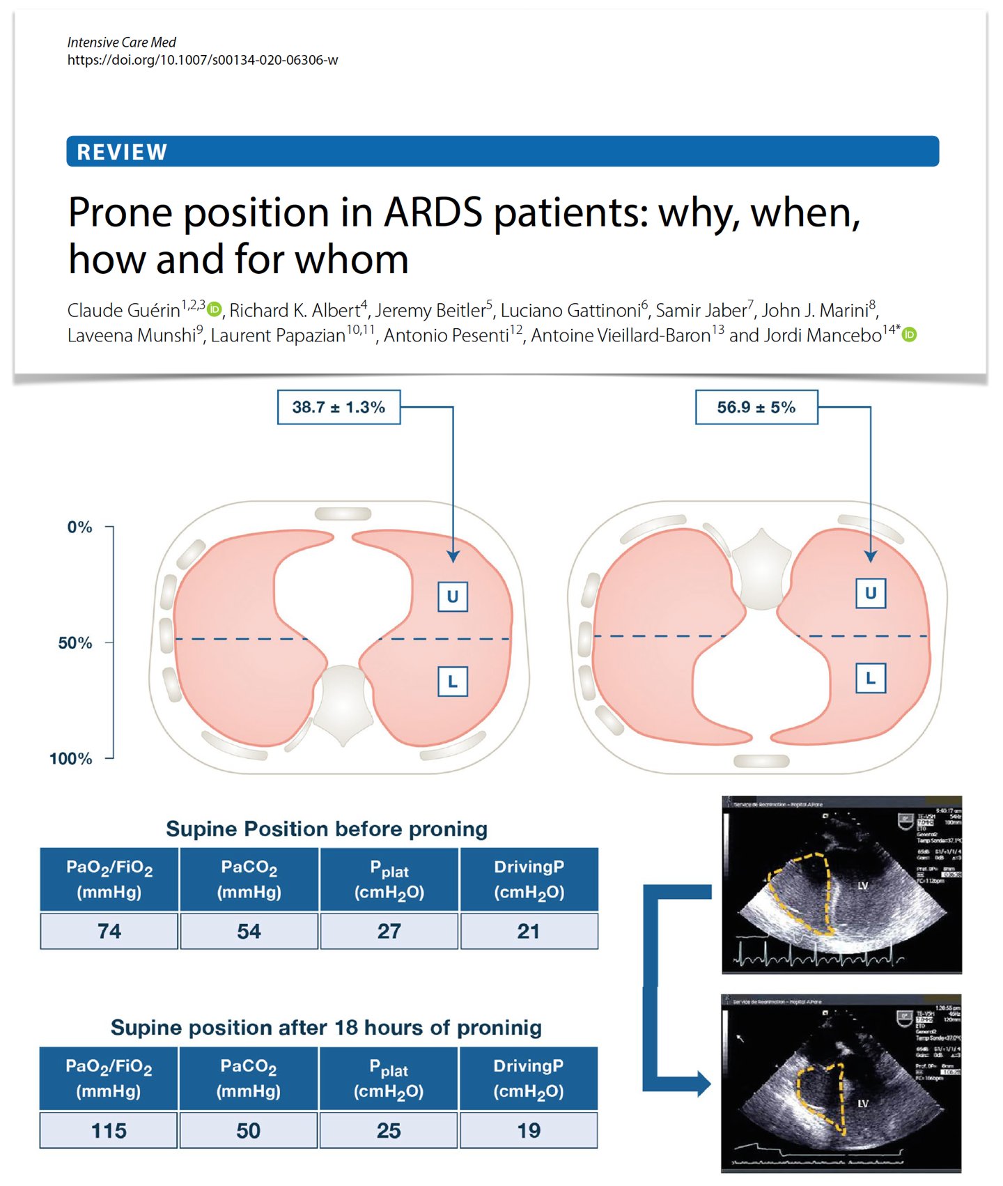 Prone Position Ards