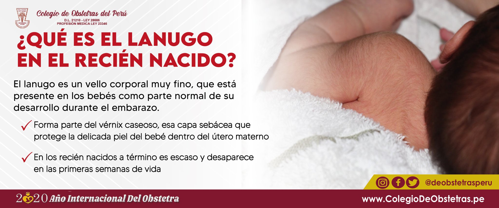 Vernix Caseosa And Lanugo