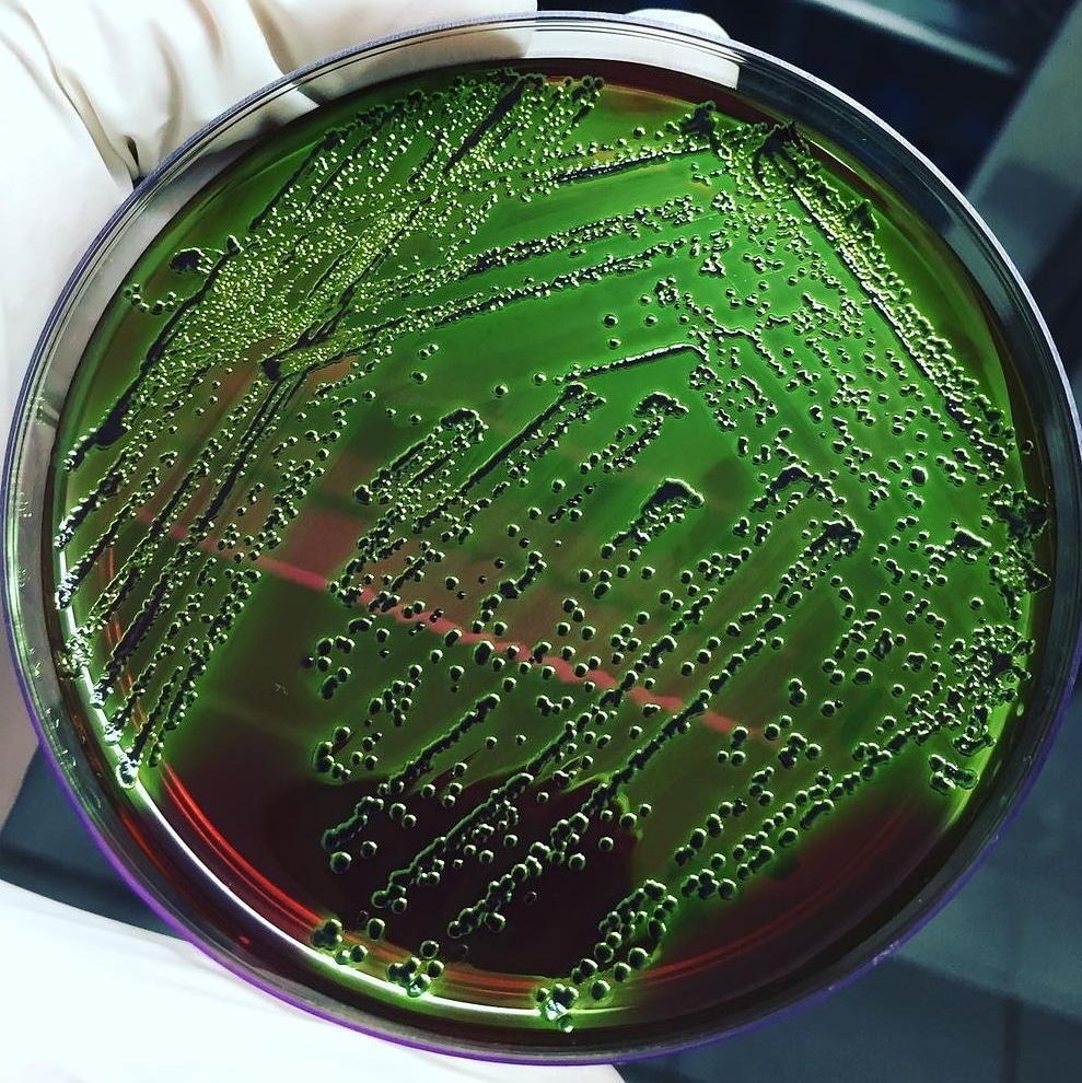 E Coli On Emb Agar
