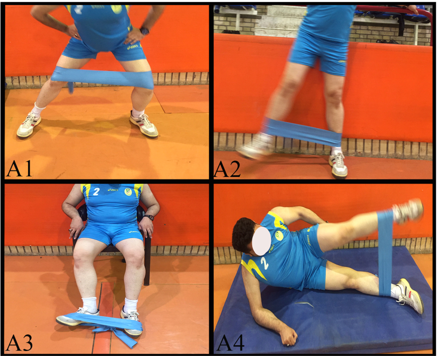 Genu Valgum Exercises