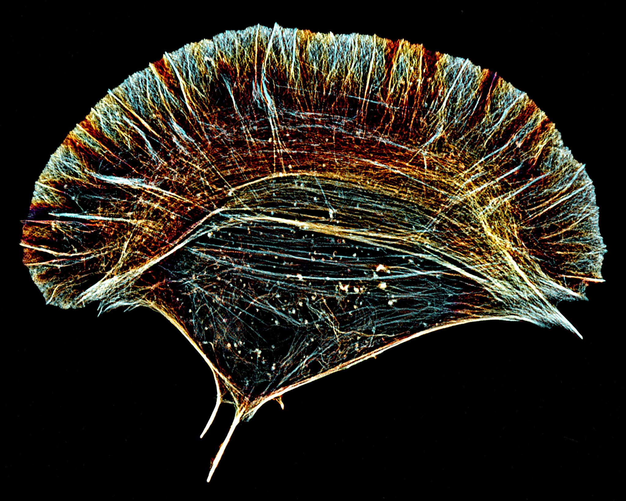 Cytoskeleton Microscope