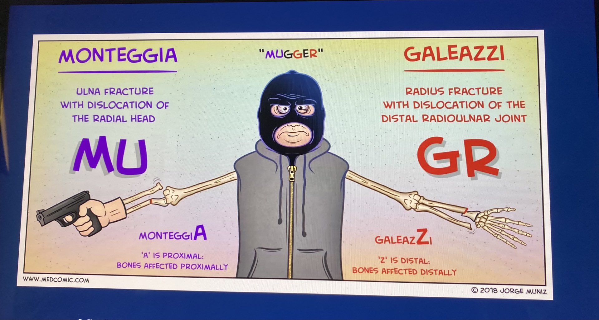 Monteggia Vs Galeazzi Monteggia Fracture Causes, Symptoms, Treatment
