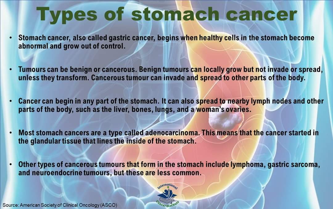 Gastric Cancer Types