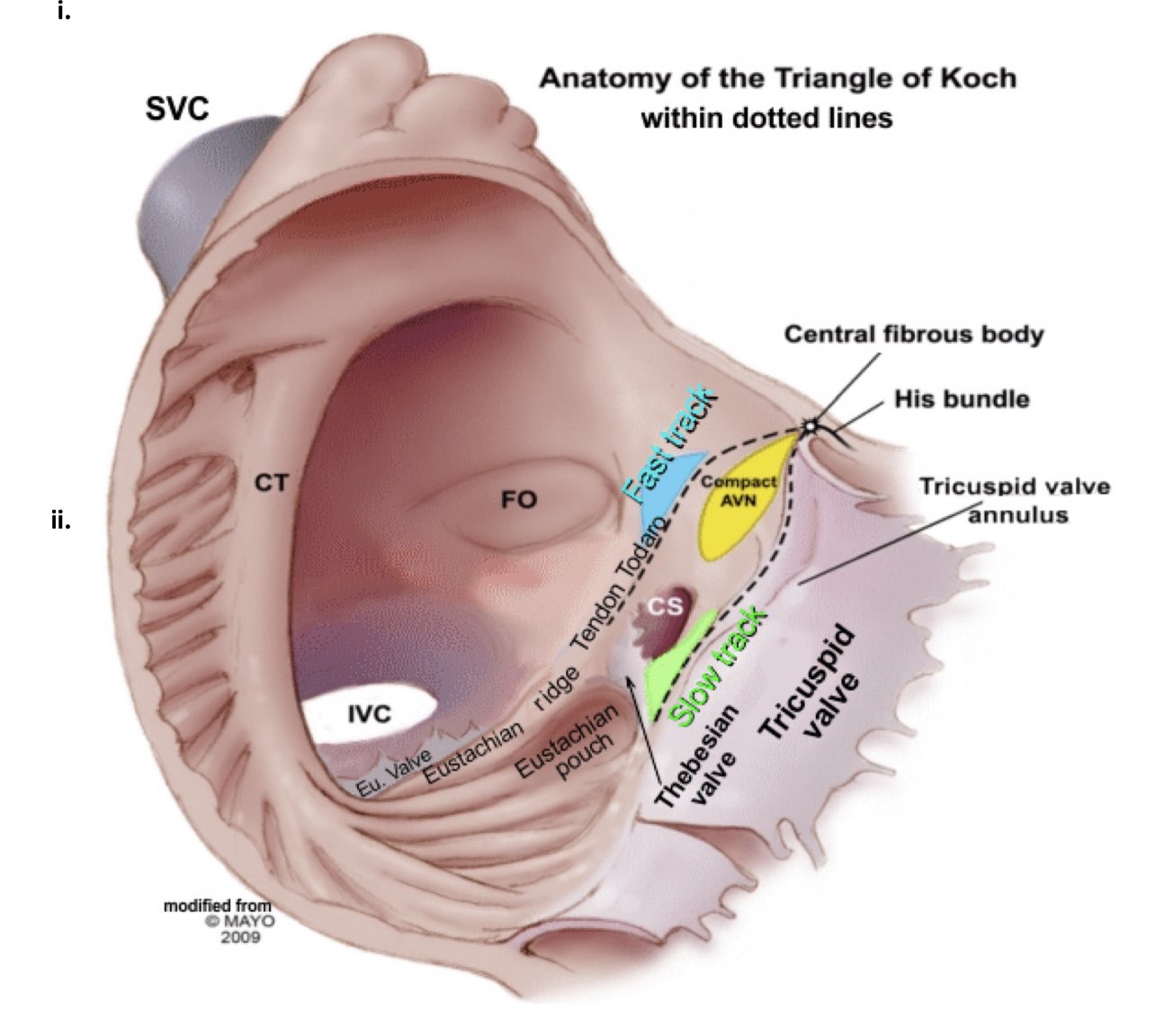 Sulcus Terminalis Heart