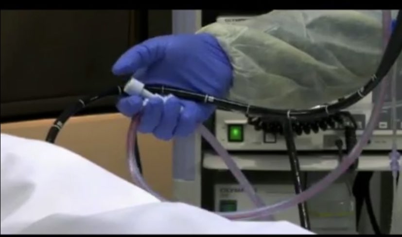Let’s talk tricks for augmenting suction during endoscopy, as big clots ...