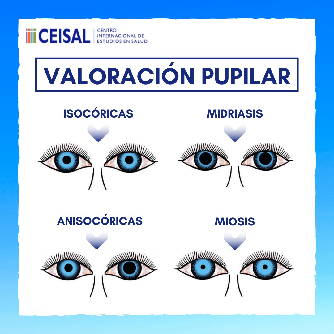 Pupilas Isocóricas E Fotorreagentes - RETOEDU