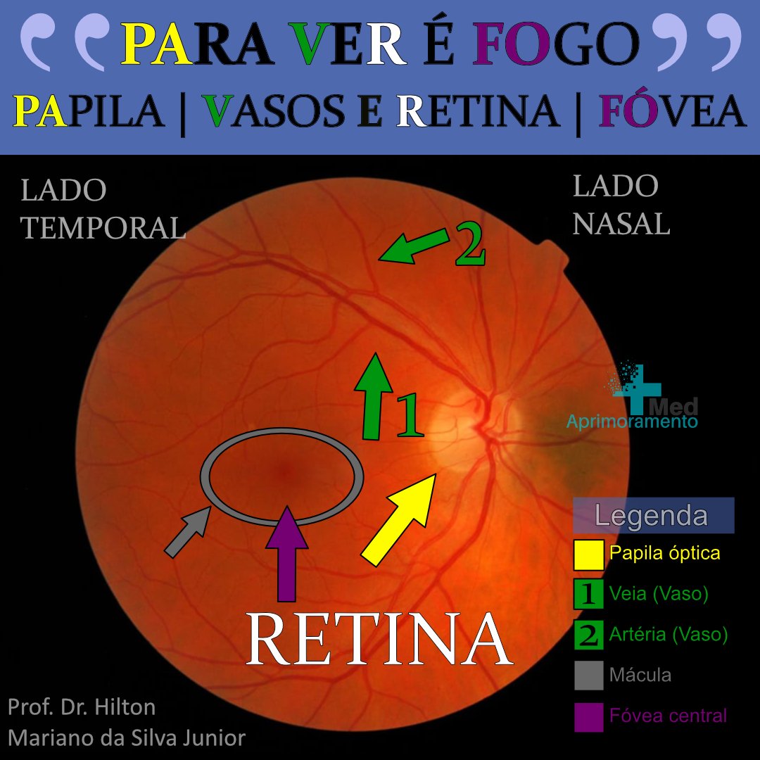 Exame De Fundo De Olho Normal - REVOEDUCA