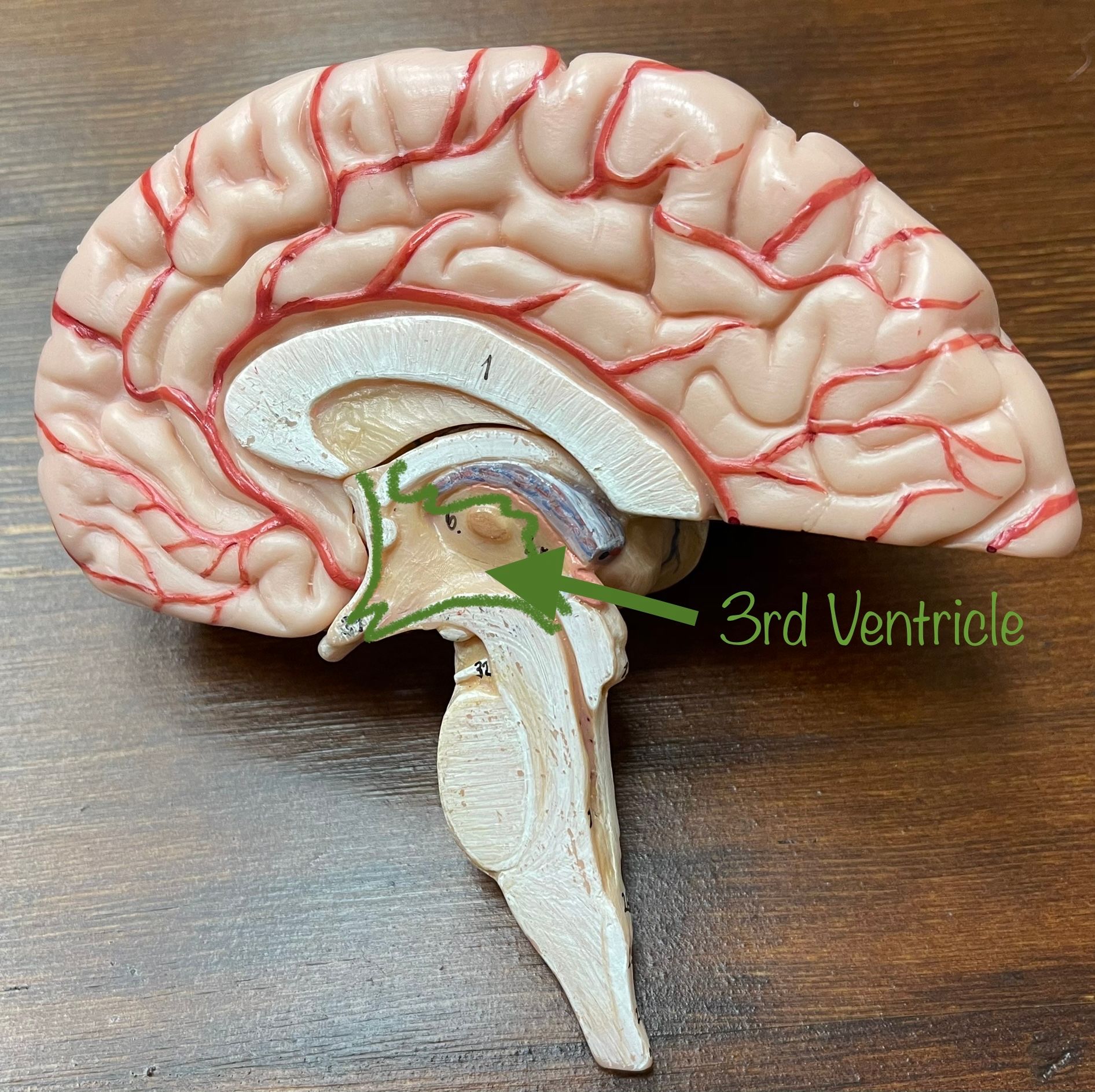 Ventricles Of The Brain Model